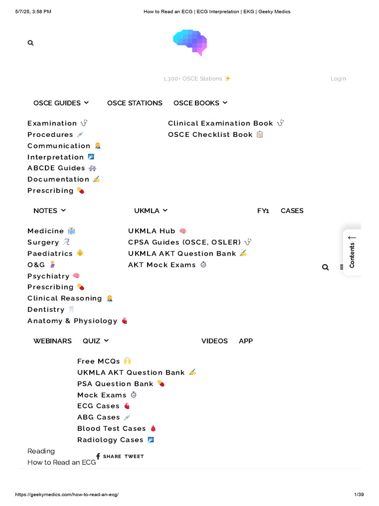 How To Read An ECG - ECG Interpretation - EKG - Geeky Medics | PDF ...