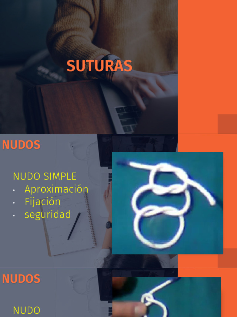 ECOE (NUDOS Y SUTURAS) | PDF
