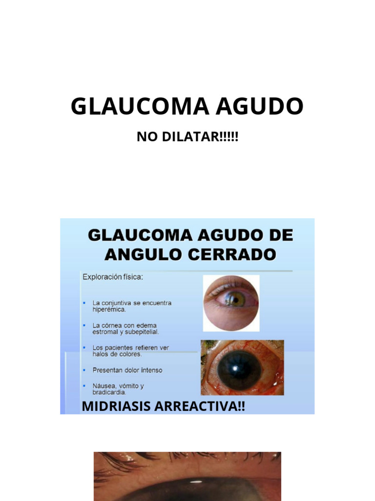 Midriasis Arreactiva!! | PDF