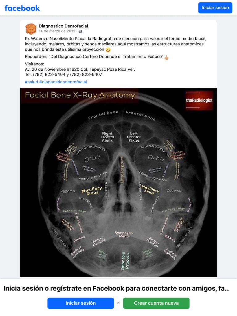 RX Waters o NasoMento Placa, La... - Diagnostico Dentofacial Facebook | PDF