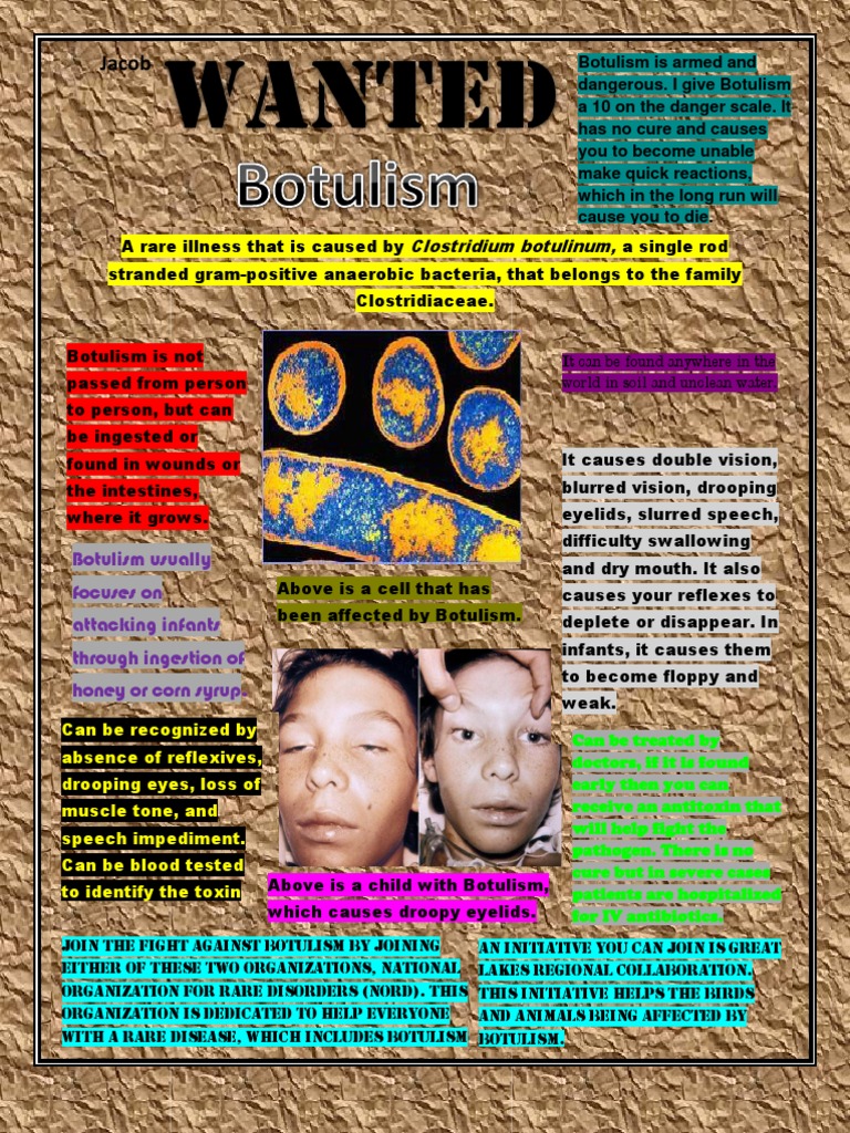 Wanted Poster | Download Free PDF | Botulinum Toxin | Diseases And ...