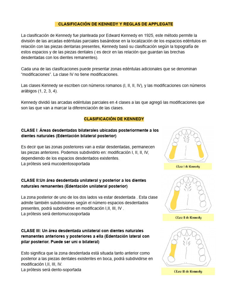 CLASIFICACIÓN DE KENNEDY Y REGLAS DE APPLEGATE.docx | PDF | Diente ...