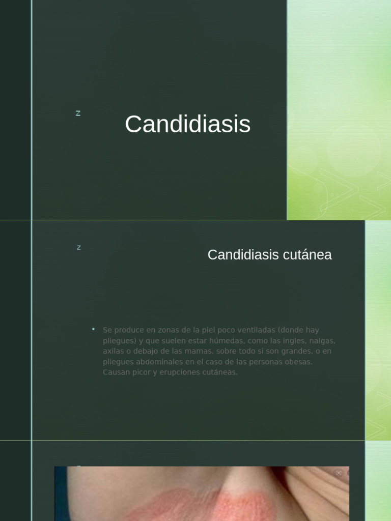 Cándida | PDF | Candidiasis | Especialidades Medicas