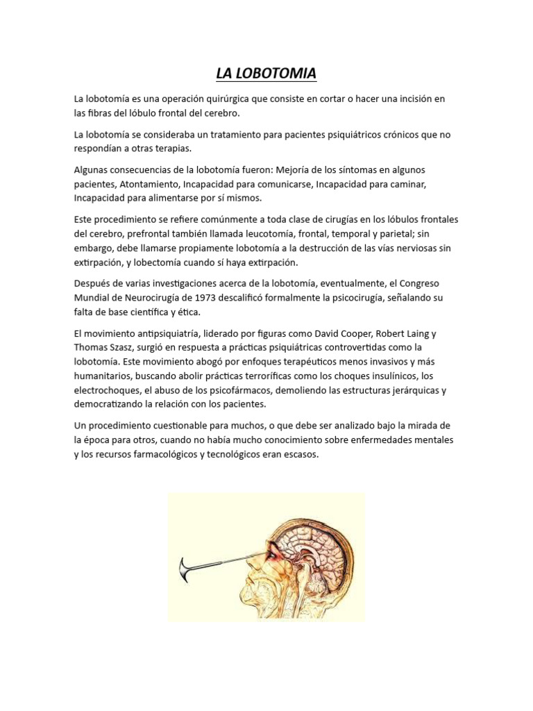 LA LOBOTOMIA Investigacion Corta | PDF