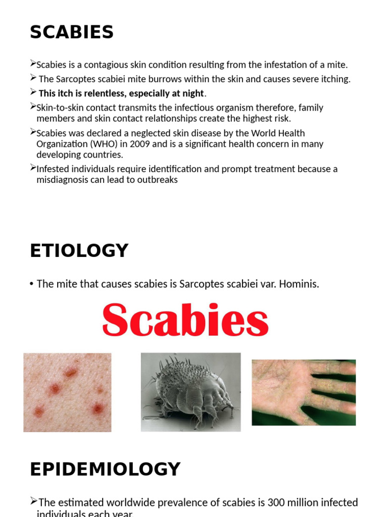 Scabies: This Itch Is Relentless, Especially at Night | PDF