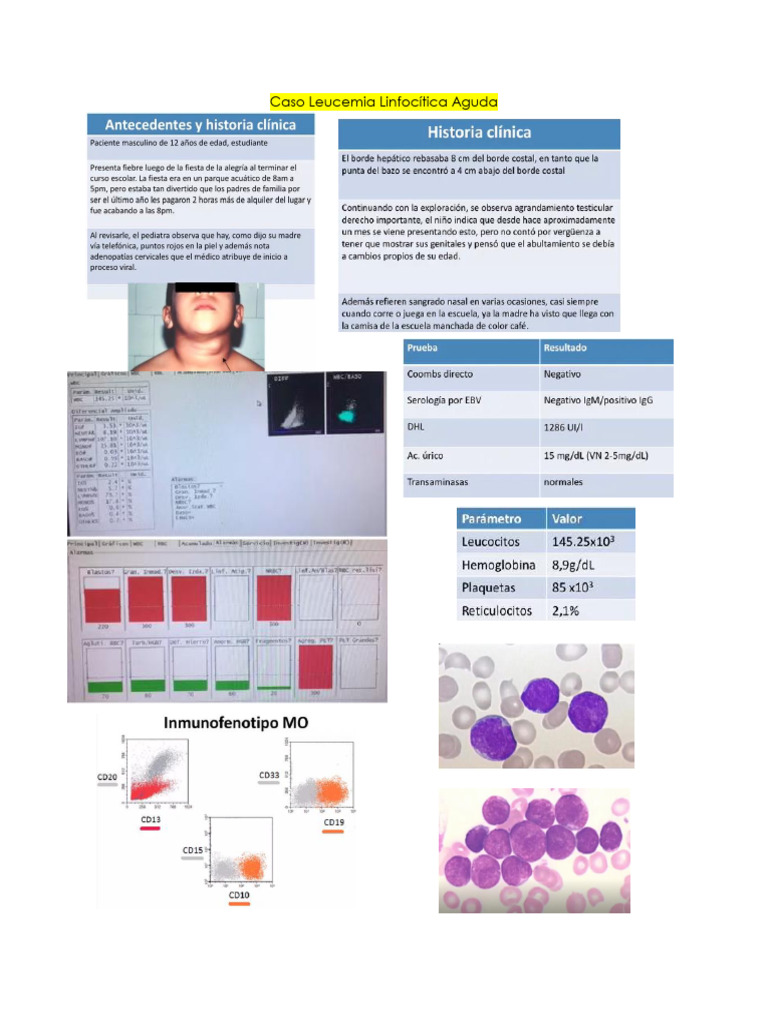 Caso Leucemia Linfocítica Aguda | PDF | Leucemia | Hematopoyesis