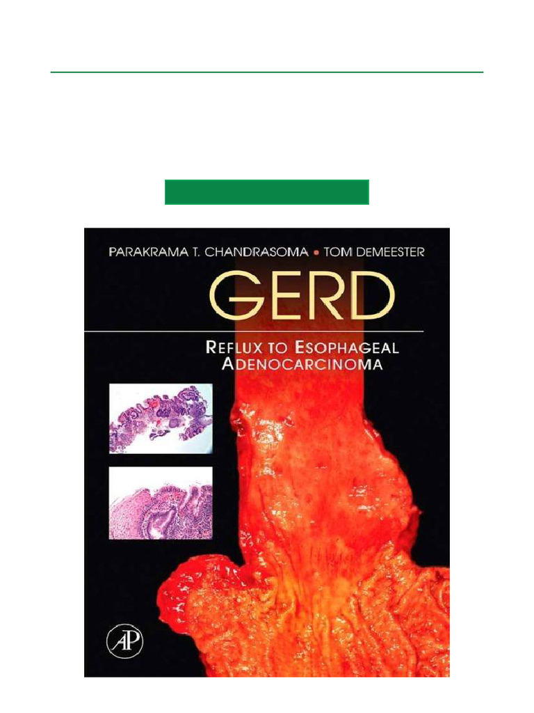GERD and Esophageal Adenocarcinoma Guide | PDF | Esophagus ...