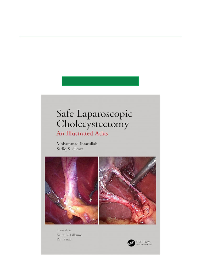 Safe Laparoscopic Cholecystectomy Atlas | PDF | Gallbladder | Liver