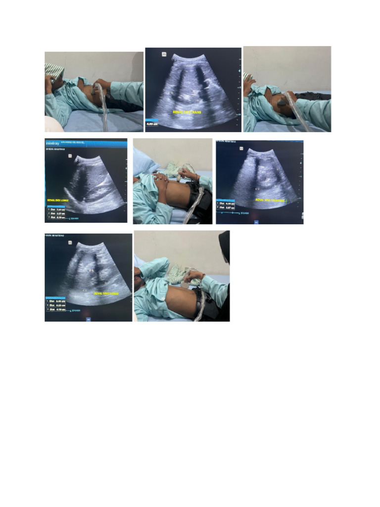 Renal Usg Print | PDF