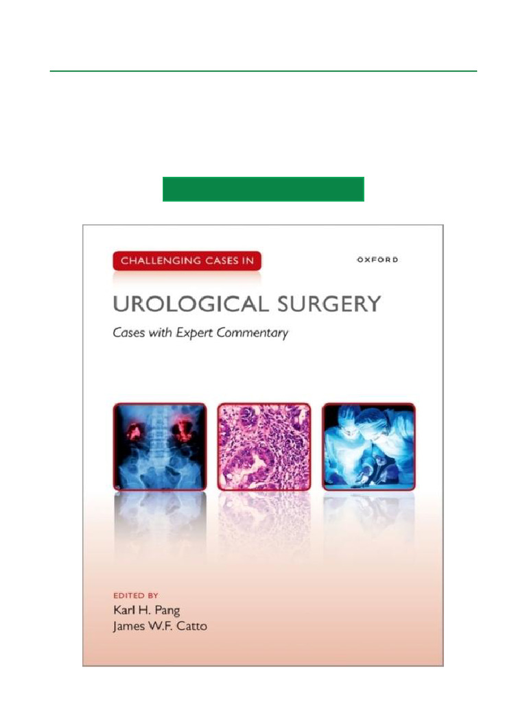Expert Insights on Urological Surgery Cases | PDF | Urology | Prostate