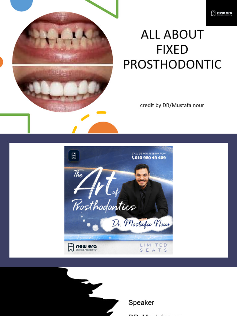 All About Fixed Prosthodontic Mustafa Nour | PDF
