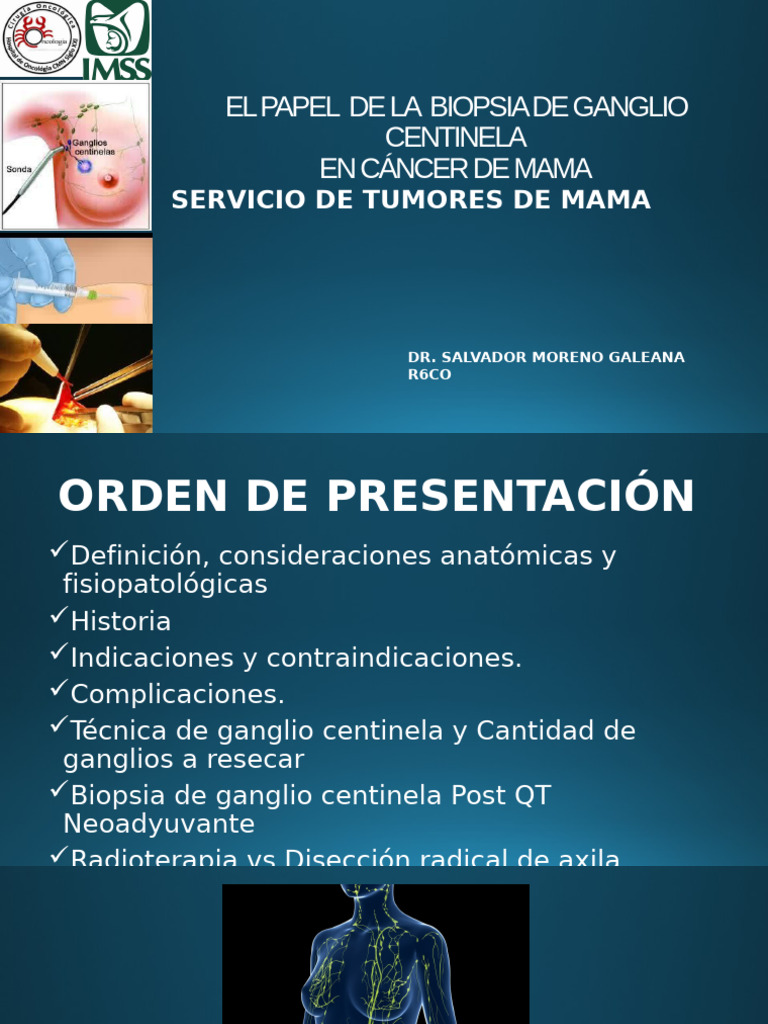 Biopsia de Ganglio Centinela en Cáncer de Mama | PDF | Cáncer ...