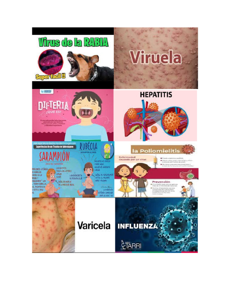 Viruela | PDF