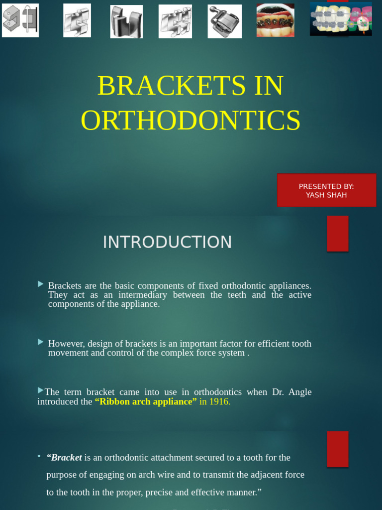 Overview of Ribbon Arch Brackets | PDF | Orthodontics | Dentistry Branches