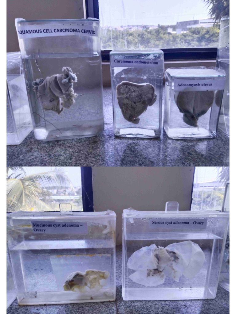 Pathology Specimens | PDF