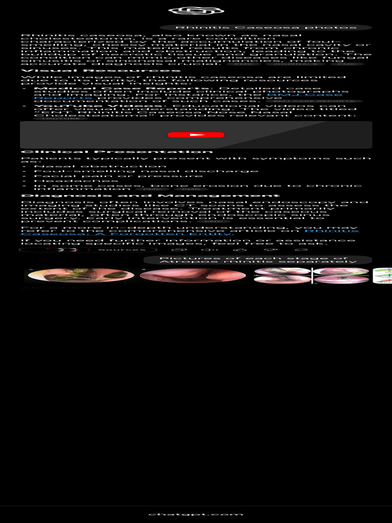 Rhinitis Caseosa Overview | PDF