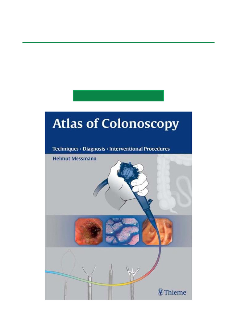 Atlas of Colonoscopy Techniques Diagnosis Interventional Procedures ...