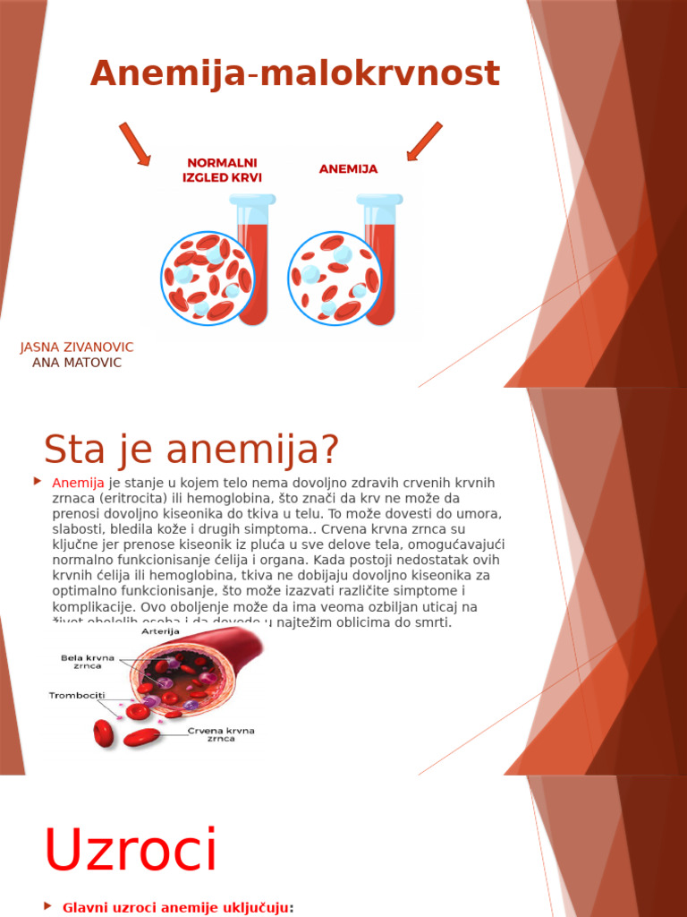 Anemija Malokrvnost 1a0136b6 A09f 4058 b1c9 6f4cbada04a6 | PDF