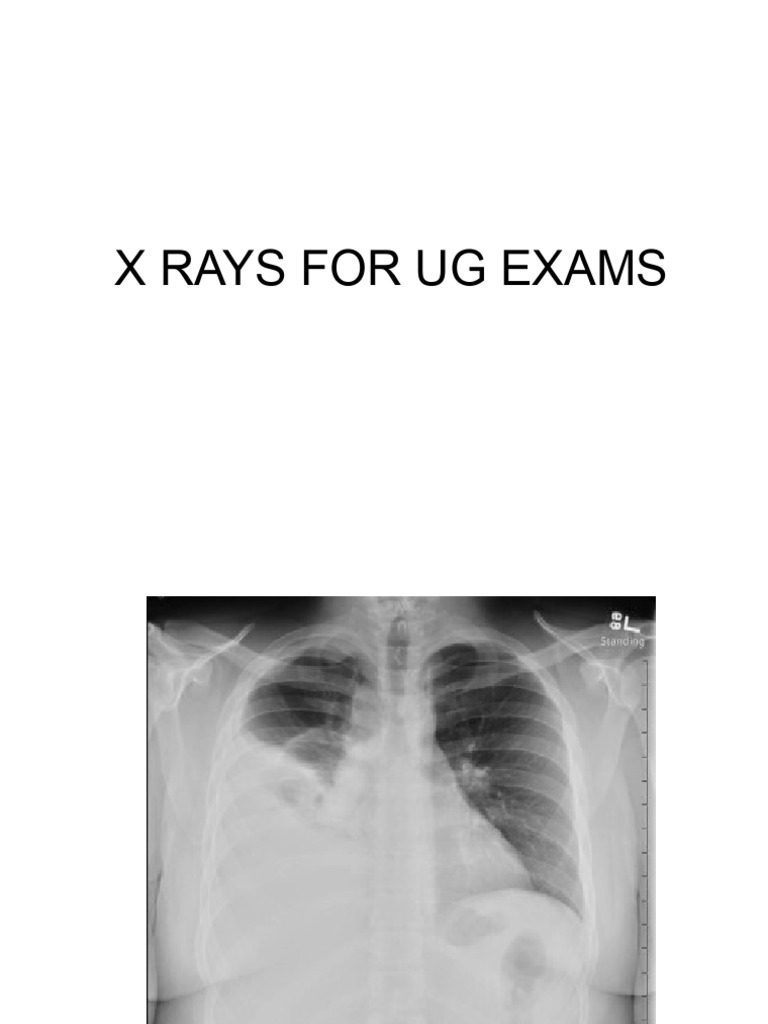 Xrays Ugs | PDF