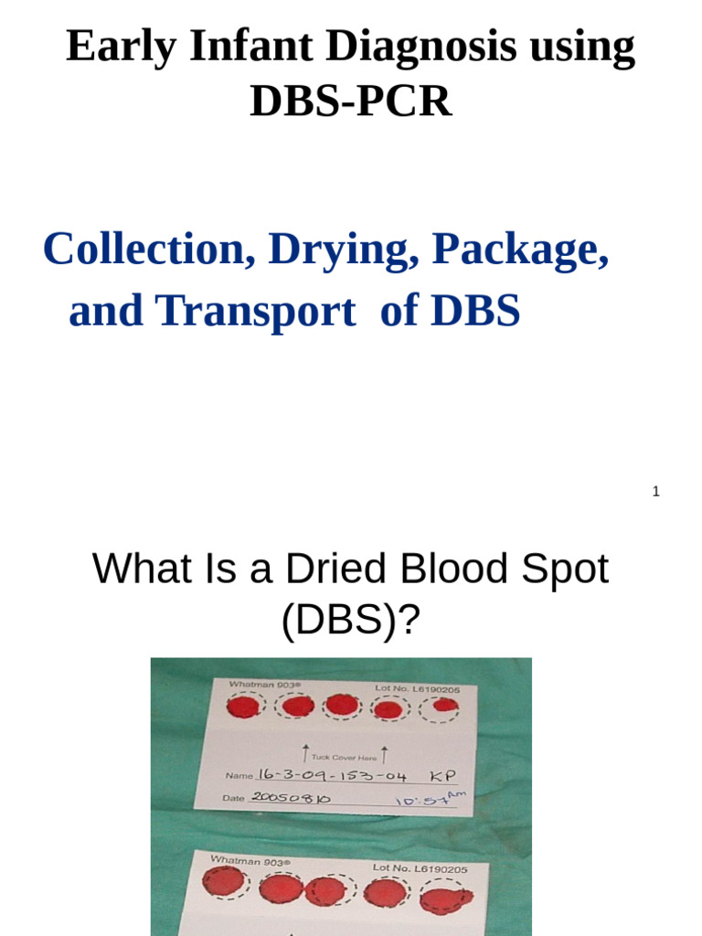 DBS Sample Collection | PDF