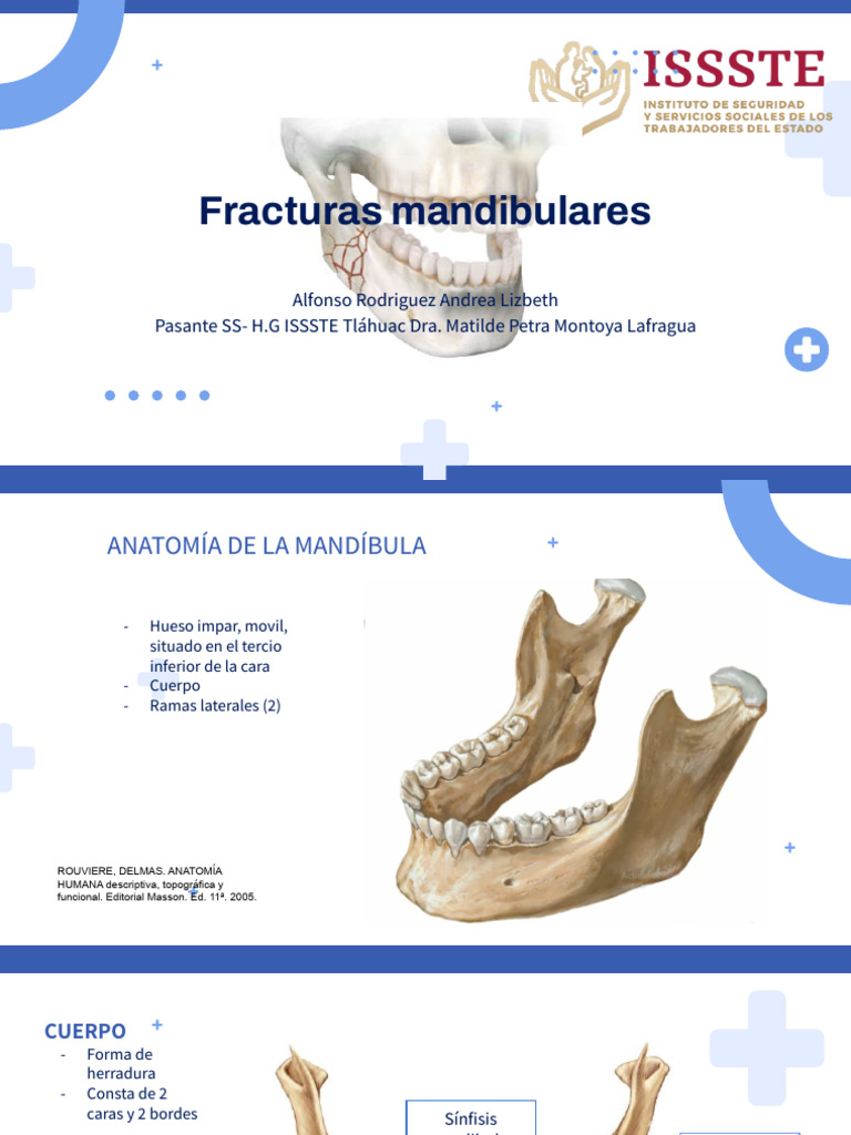 Fracturas Mandibulares: Causas y Tratamiento | PDF | Anatomía