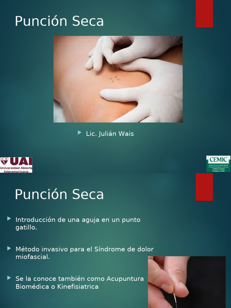Puncion Seca | PDF | Acupuntura | Dolor