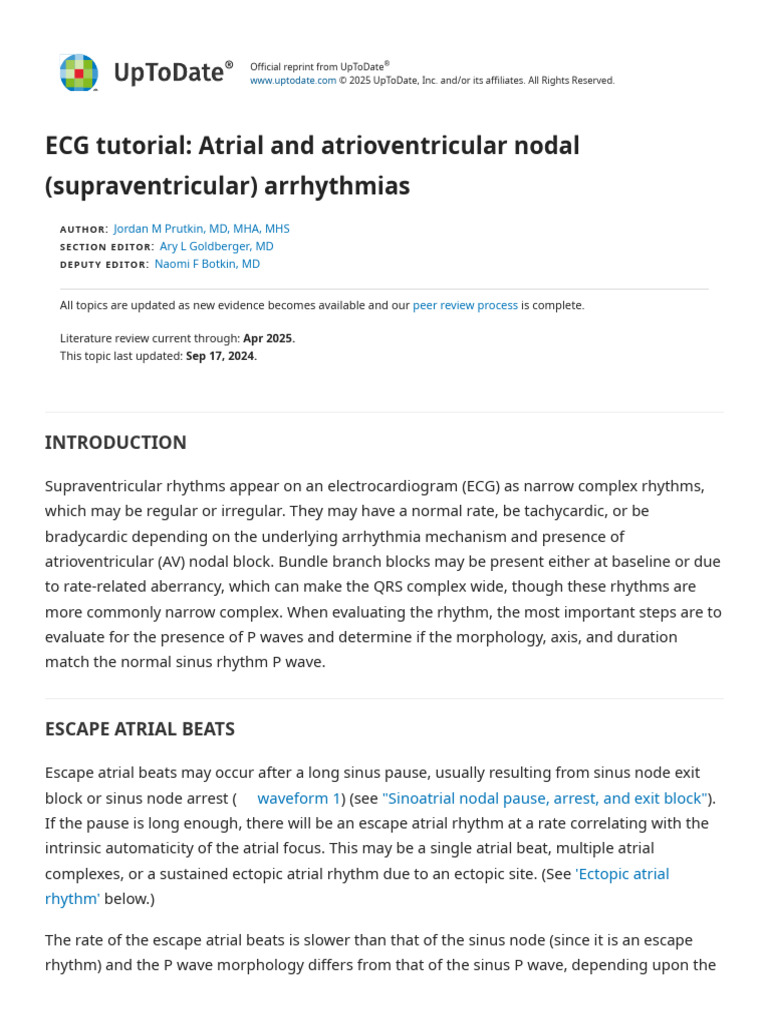 ECG Tutorial - Atrial and Atrioventricular Nodal (Supraventricular) Arrhythmias - UpToDate | PDF ...