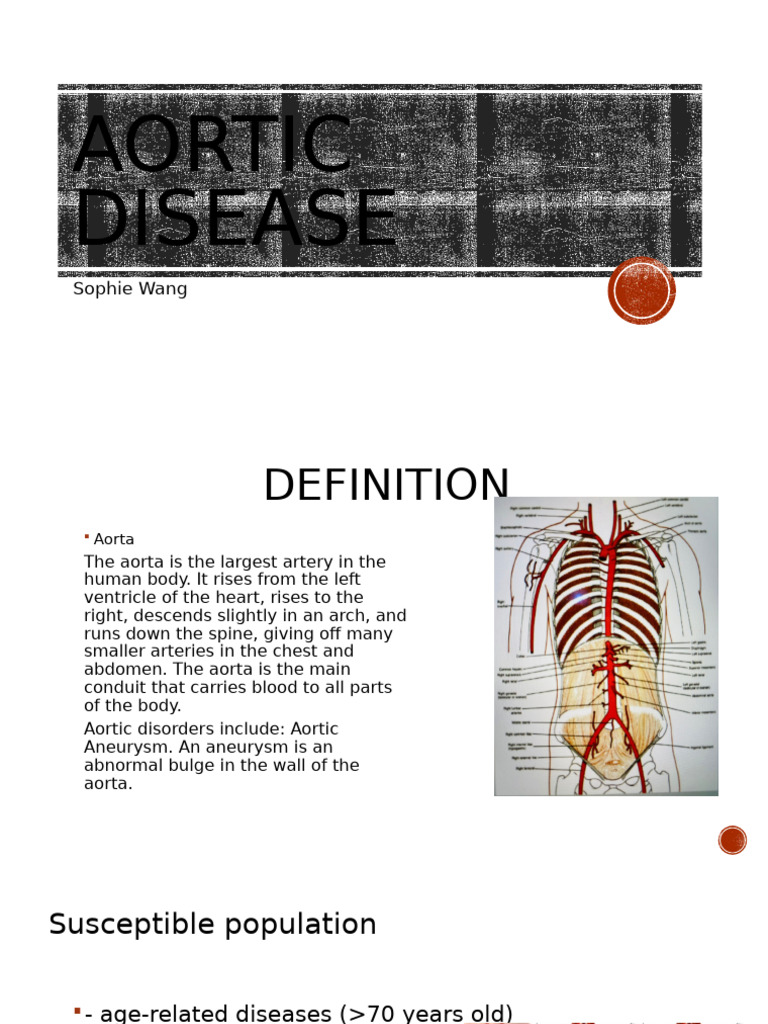 BIOLOGY Aortic Disease | PDF