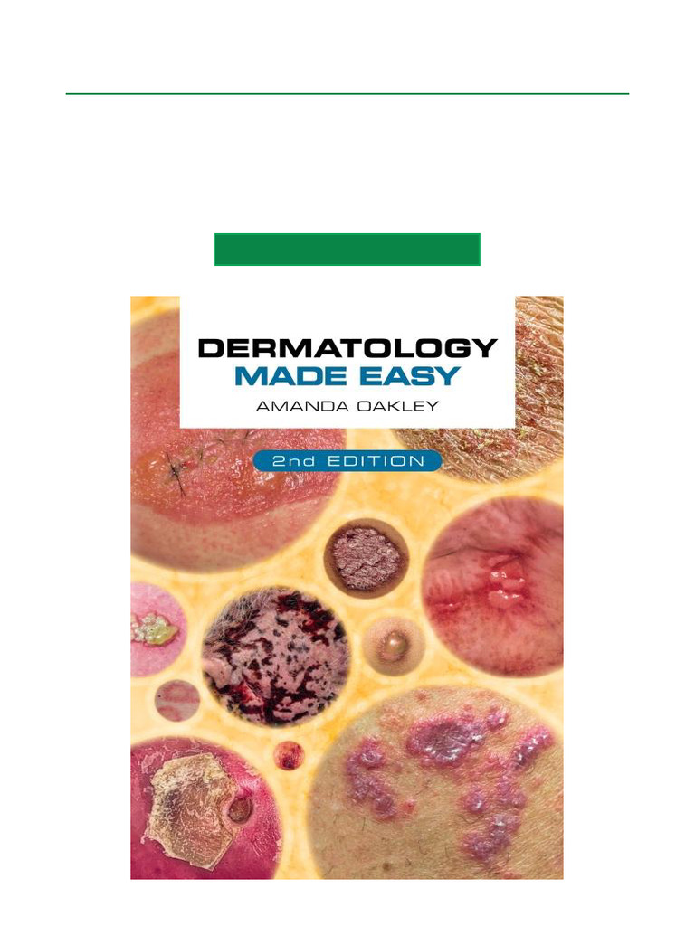 Dermatology Made Easy, Second Edition - 2nd Edition Full Text PDF | PDF ...