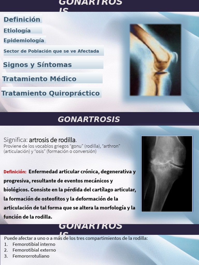 Gonartrosis: Causas, Síntomas y Tratamientos | PDF | Rodilla ...
