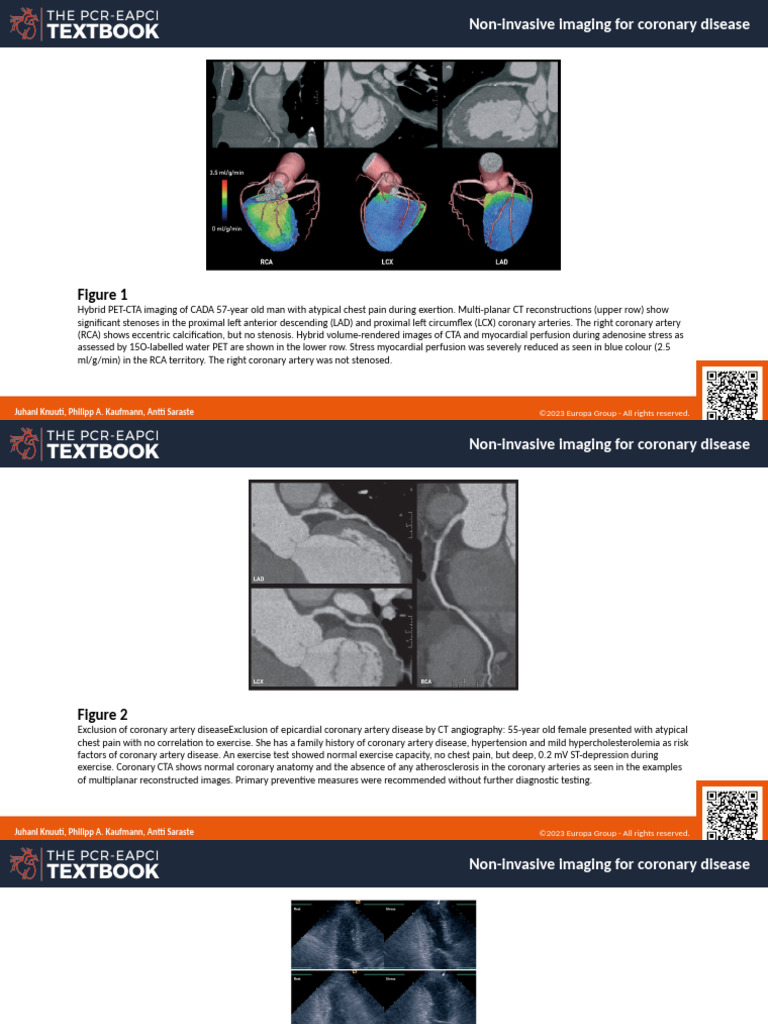 PCR Eapci Textbook Chapter Non Invasive Imaging For Coronary Disease ...
