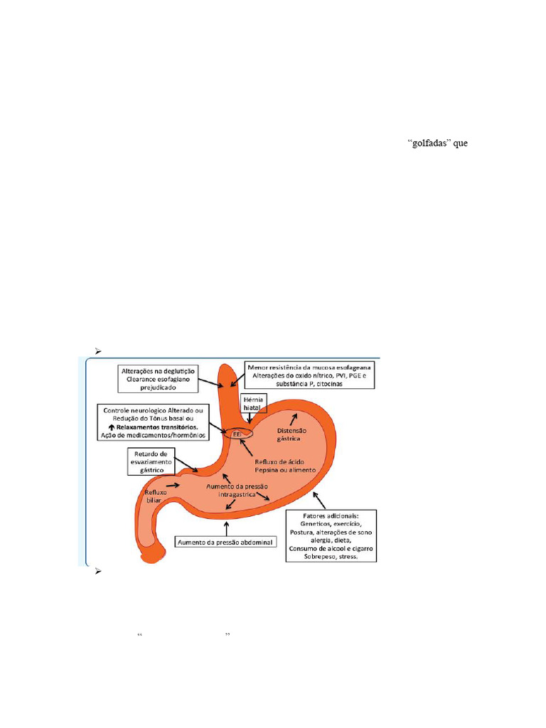 Doença Do Refluxo Gastroesofágico | PDF | Doença do refluxo ...