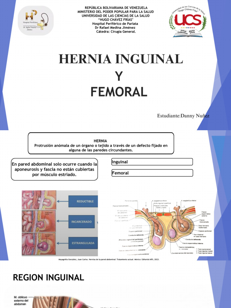 Hernias Inguinal y Femoral | PDF
