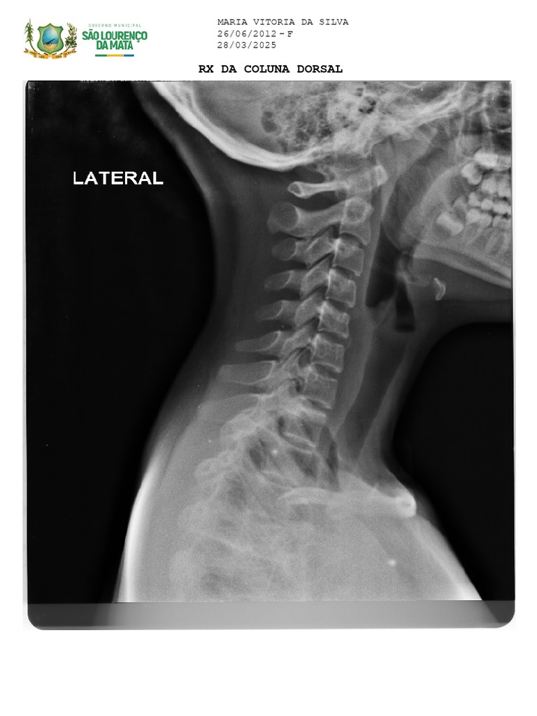 RX da Coluna Dorsal - Maria Vitória | PDF