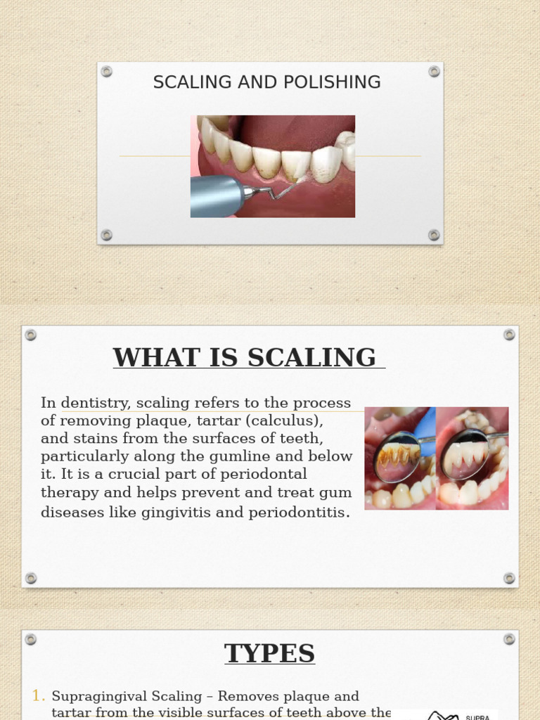 Scaling and Polishing | PDF