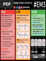 Wellens Syndrome ECG Patterns Explained | PDF | Electrocardiography ...