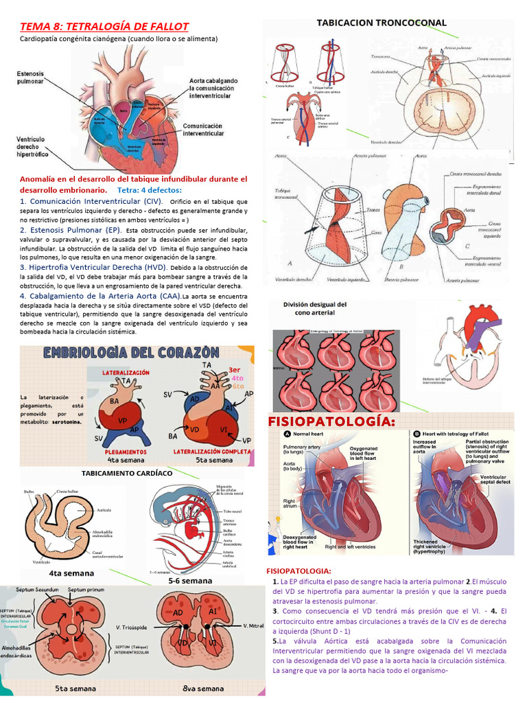 Res 9 - Tetralogía de Fallot | PDF | Ventrículo (corazón) | Corazón
