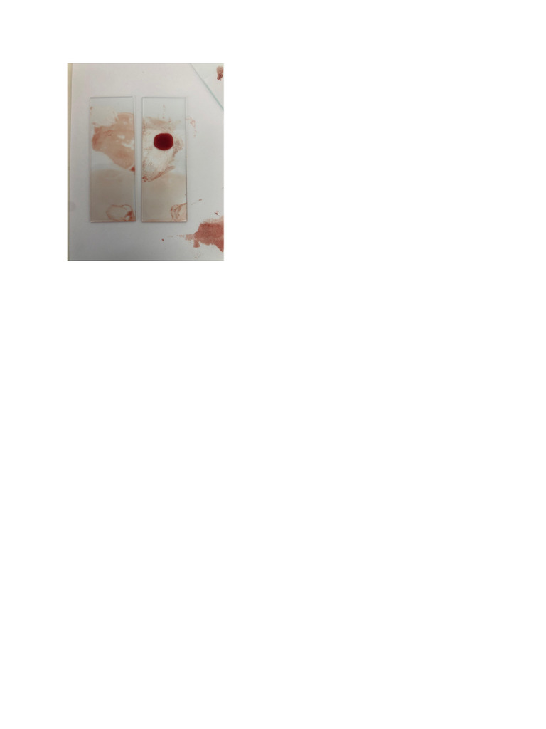 Smear | PDF