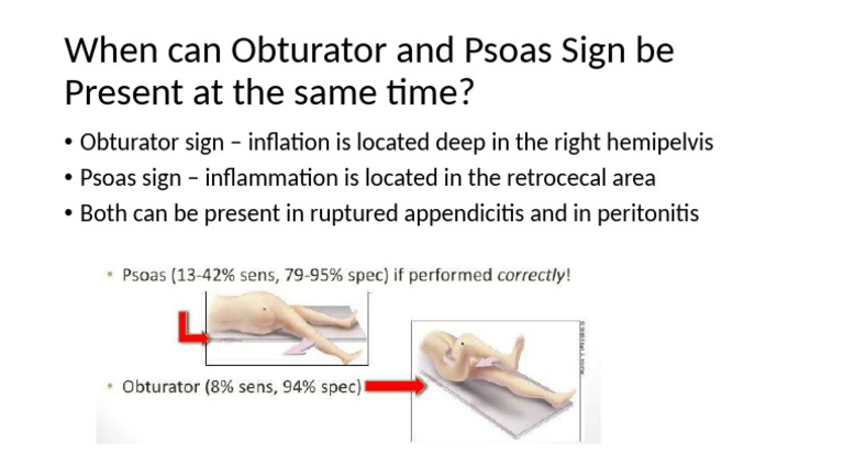 When Can Obturator and Psoas Sign Be Present | PDF