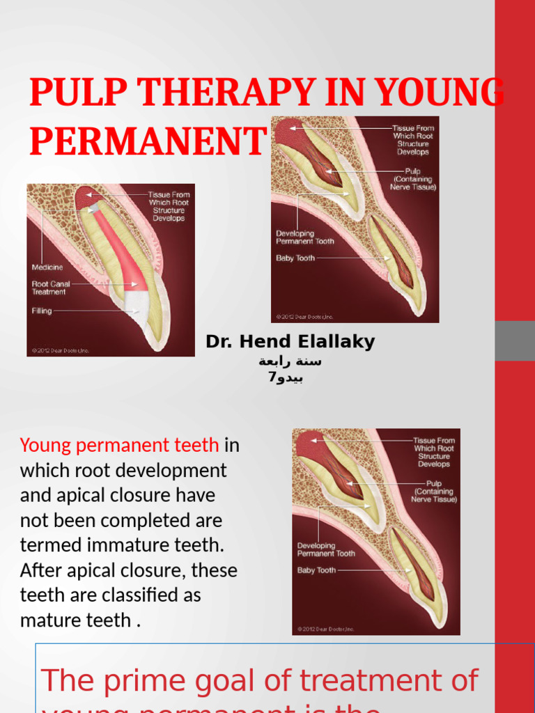 Pulp Therapy for Young Permanent Teeth | PDF | Dental Anatomy | Tooth