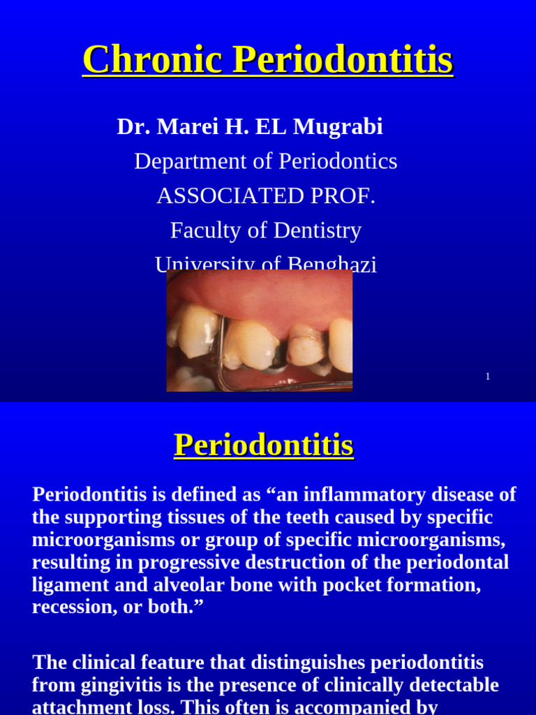 Chronic Periodontitis | PDF | Periodontology | Clinical Medicine