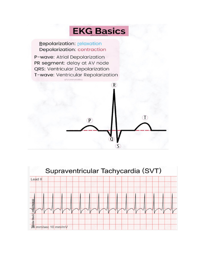 Ekg | PDF
