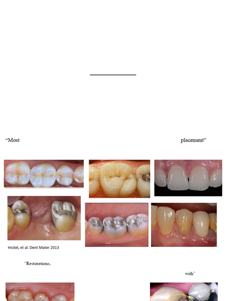 Diagnosis and Assessment of Failed Restorations | PDF | Dentistry ...