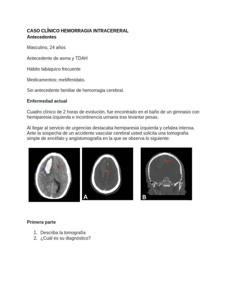 CASO CLÍNICO ACV HEMORRÁGICO | PDF