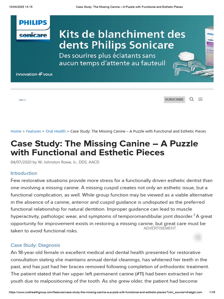 Case Study - The Missing Canine - A Puzzle With Functional and Esthetic ...