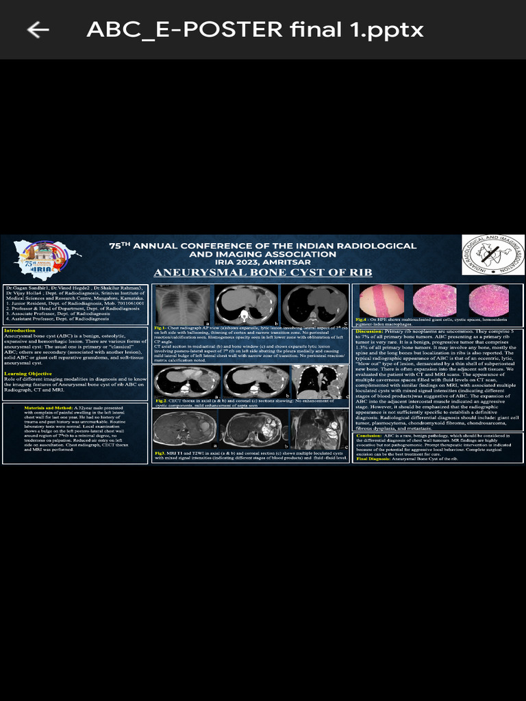 ABC - E-POSTER Final 1.pptx - Google Slides | PDF