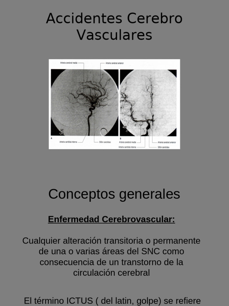 Evento Vascular Cerebral | PDF | Carrera | Isquemia