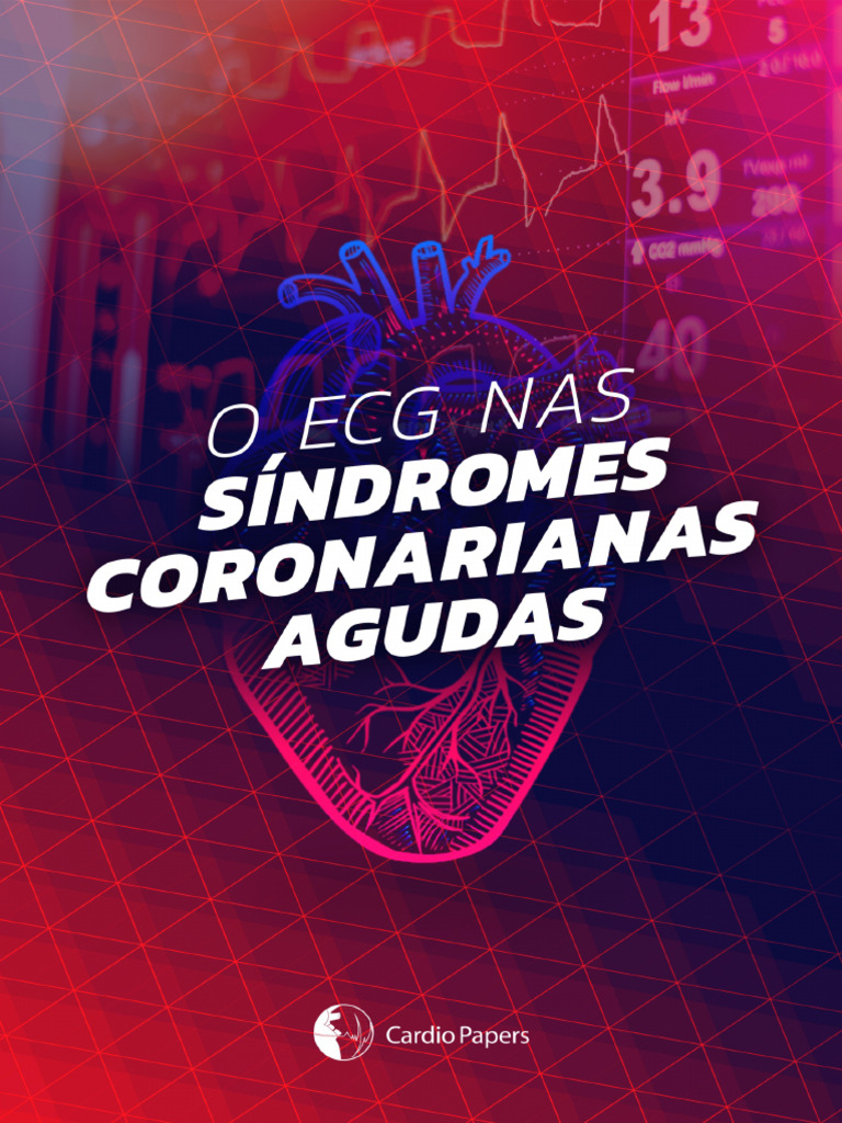Ecg Nas Sca 2 | PDF