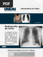 Proyecciones Rx de Tórax: PA y AP | PDF | Tórax (anatomía humana ...