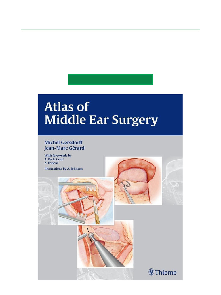View Atlas of Middle Ear Surgery 1st Edition Complete Book Download | PDF